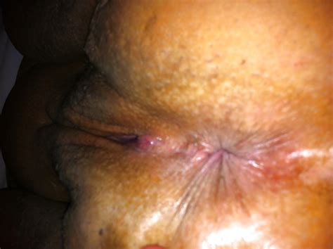 Backside Pic Porn Pictures Xxx Photos Sex Images 1191742 Pictoa