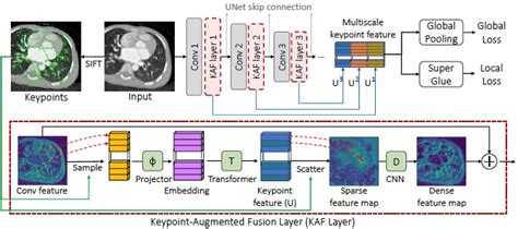 Keypoint Augmented Self Supervised Learning For Medical Image Segmentation With Limited
