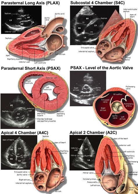 Echocardiogram And Pocus Cardiology Windows And Anatomy Medicine Notes Vet Medicine Echocardiogram And Pocus Cardiology Windows And Anatomy Medicine Notes Vet Medicine