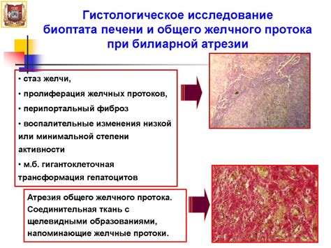 Пороки развития и заболевания желчных протоков и желчного пузыря у детей презентация онлайн