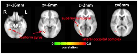 Whole Brain Correlation Map Showing Regions That Exhibit A Significant