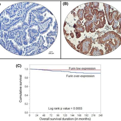 Immunohistochemical Analysis Of Furin Expression In Papillary Thyroid