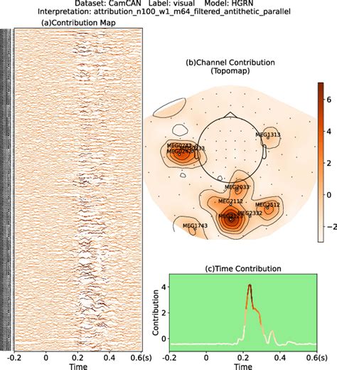 Figure 11 From A Model Agnostic Feature Attribution Approach To Magnetoencephalography