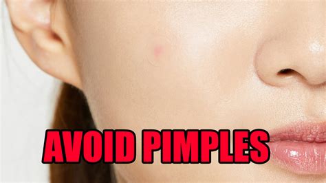 Tips To Avoid Pimples And Get Flawless Shining Look IWMBuzz