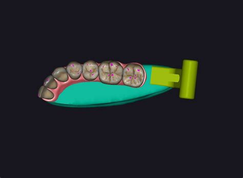 🦷 Occlusion Teeth Contact Points・ Stl File For 3d Printing・cults