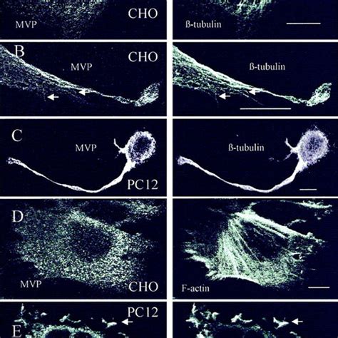 Distribution Of Vaults And β Tubulin Or F Actin In Cho And Pc12 Cells