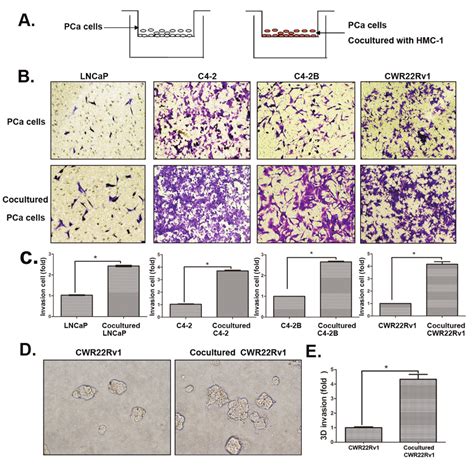 Increased Infiltrating Mast Cells To Pca Enhanced Pca Cell Invasion A