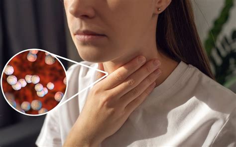 Qué Es La Streptococcus Pyogenes Se Reportan 93 Muertes En Argentina