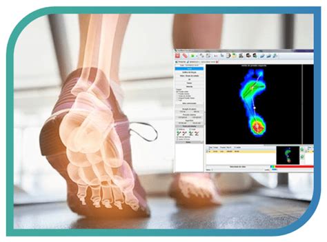 Baropodometría Paul Riveros