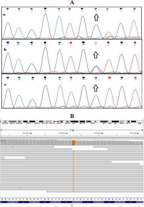 A The Electropherogram Sequencing Identified C2287c G Variant