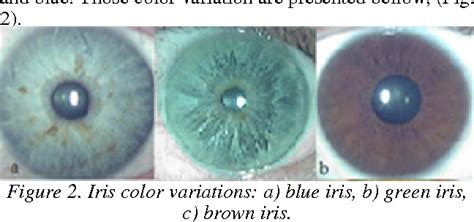 Figure 2 From Medical Diagnosis System Based On Iris Analysis Semantic Scholar
