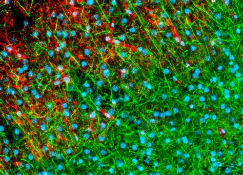 Mouse Brain Tissue Sections Nikons Microscopyu