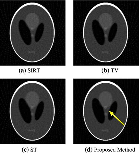 The Result From The Reconstruction Algorithms Using A Sirt B Tv C St Download Scientific