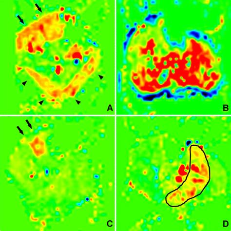 Representative Perfusion Maps Of Each Study Group Demonstrate The Download Scientific Diagram