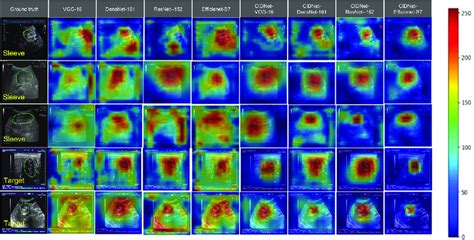 Grad Cam Resultant Saliency Maps Of Deep Learning Models For Five Download Scientific Diagram