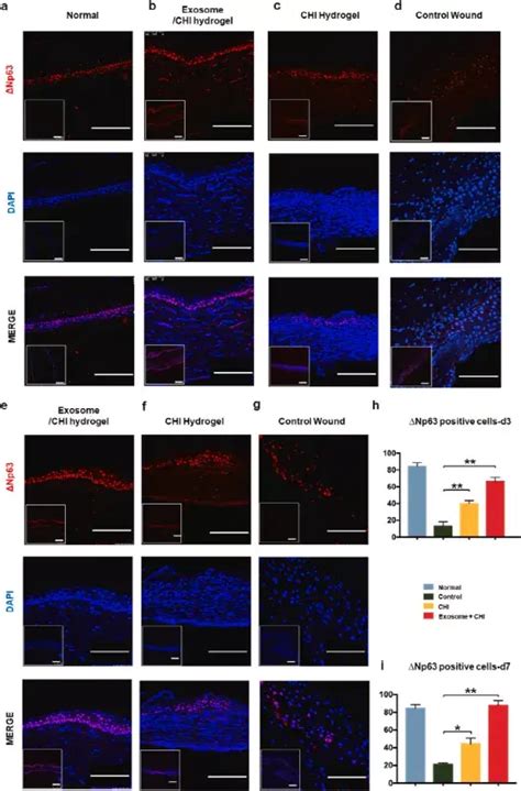 《biomaterials》浙大周民 姚克：外泌体负载热敏水凝胶用于角膜上皮和基质再生 知乎