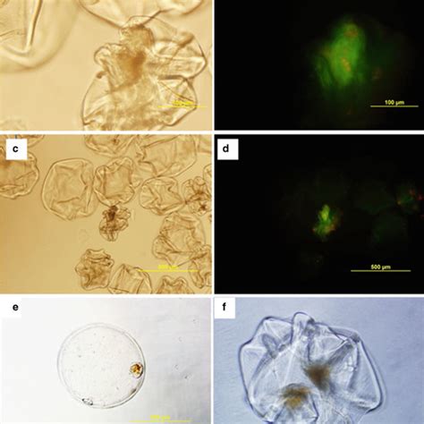 Live Dead And Dithizone Staining Of Retrieved Encapsulated Islets