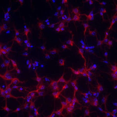 Isolation And Culture Of Mouse Cortical Neurons