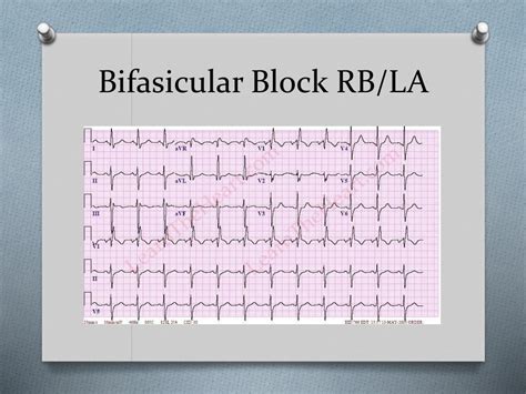 Ppt Cardiology Ii Powerpoint Presentation Free Download Id 2244589