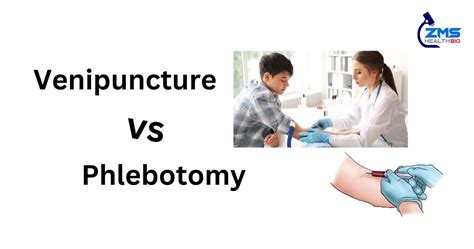 Difference Between Venipuncture And Phlebotomy Zms Healthbio