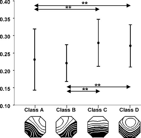 Spatial Configuration Of Four Microstate Classes A D Over All Download Scientific Diagram