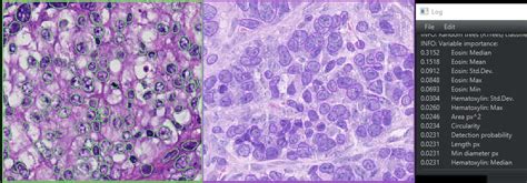 measuring nuclear texture with qupath image analysis image sc forum