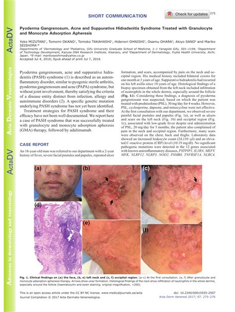 Pdf Pyoderma Gangrenosum Acne And Suppurative Hidradenitis Syndrome Treated With Granulocyte