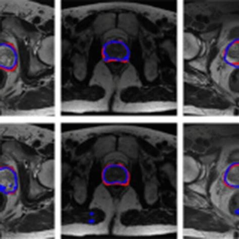 Top Row Segmentation Results Of U Net Without Long Skip Connections Download Scientific
