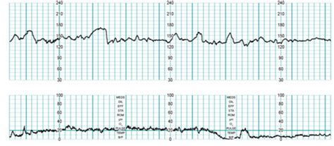 Ob Lab Quiz Flashcards Quizlet