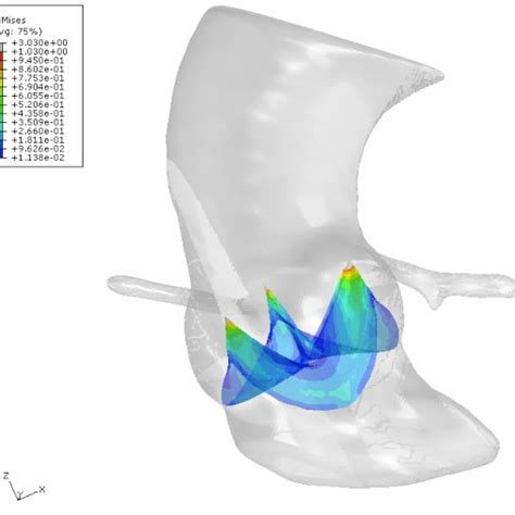 Results Of Implant Simulation Download Scientific Diagram