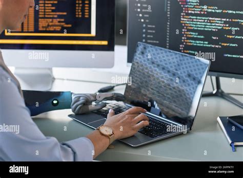 Closeup Image Of Software Developer With Bionic Arm Working On Laptop