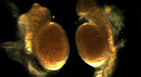 Methods Of Gene Repression During Early Development Can Be Sex Specific New Research Shows