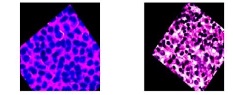 examples of transformed input images from pcam dataset download