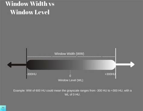 Window Width And Window Level My Ct Registry Review