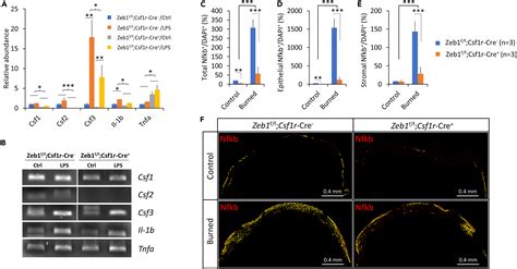 Conditional Deletion Of Zeb1 In Csf1r Cells Reduces Inflammatory