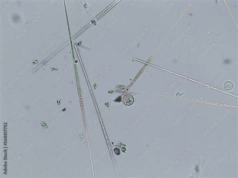 Diatoms Algae Under Microscopic View Phytoplankton Fossils Silica Golden Yellow Algae Stock
