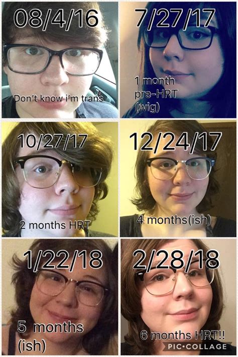 Today Marks My Six Month On Estrogen I Feel Better Every Single Day 💖 R Transtimelines