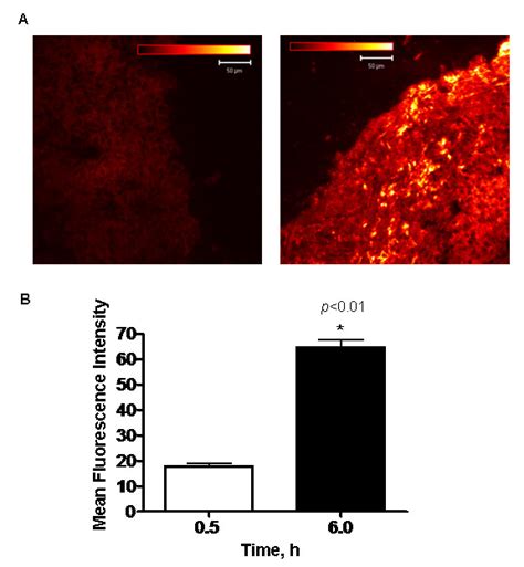 Molecular Profiling Of Angiogenesis In Hypericin Mediated Photodynamic Therapy Pmc