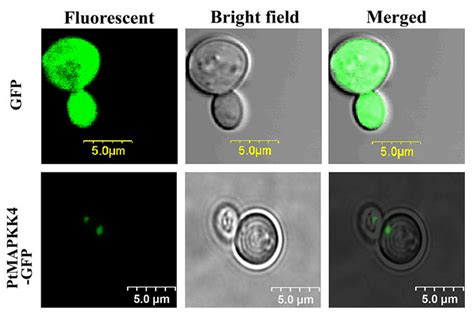 Subcellular Localization Of Ptmapkk4 Under Fluorescent Bright And
