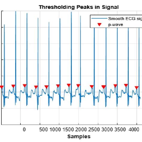 P Wave Peak Detected In Ecg Signal Download Scientific Diagram