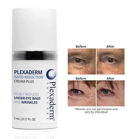 Plexaderm Rapid Reduction Cream Plus New And Improved Packaging Mihomemy