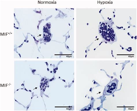 Vasoconstrictor Independent Hypoxic Vascular Resistance In Isolated Download Scientific Diagram