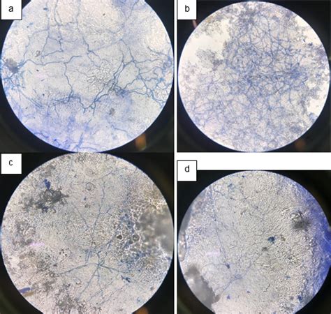 A Staining With Trypan Blue Dead Hyphae Stained Light Blue Leaving