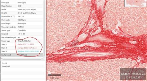 Imagej Throws Exception Rgb To 8 Bit Usage And Issues Imagesc Forum