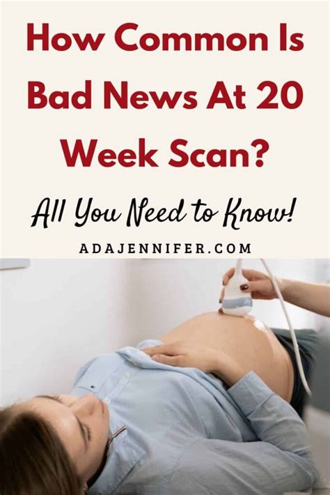 How Common Is Bad News At 20 Week Scan All You Need To Know Ada Jennifer
