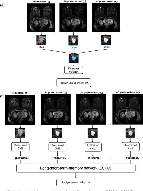 Figure 2 From Breast Lesion Classification Based On Dynamic Contrast Enhanced Magnetic Resonance