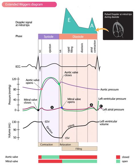 Ventricular Heart Valve At Doreen Woods Blog