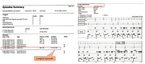 Subclinical Atrial Fibrillation How To Manage