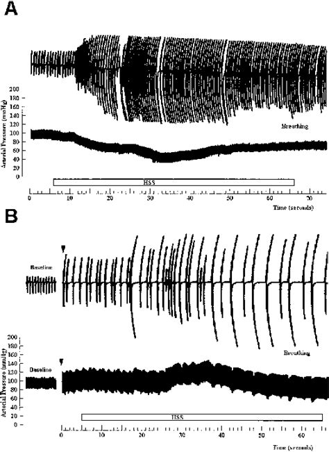 Effects Of Intravenous Slow Injections Of 7 5 Sodium Chloride Solution Download Scientific