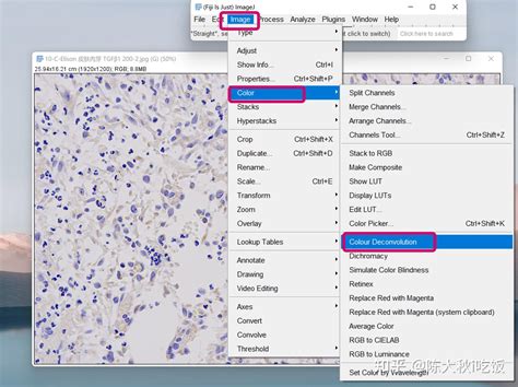 如何使用image J定量免疫组化阳性区域 知乎